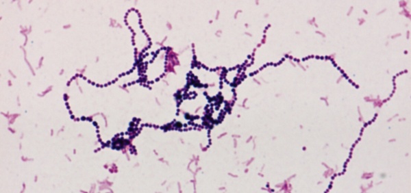Analyse des prélèvements pharyngés - microbiologiemedicale.fr