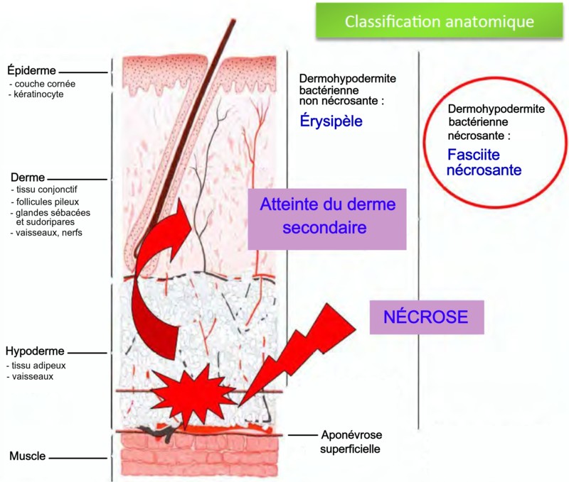 Infections cutanées primitives - microbiologiemedicale.fr