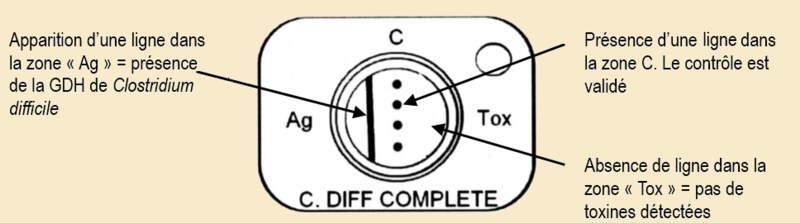 Infection intestinale coproculture cas 5