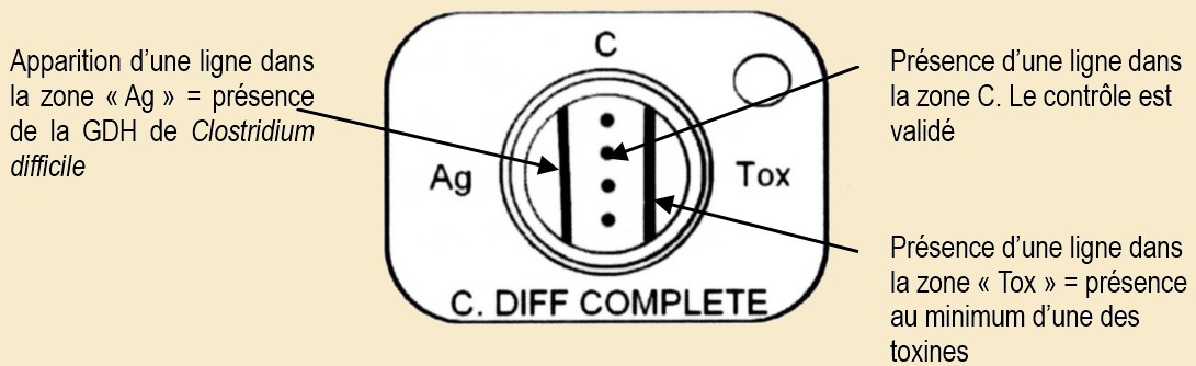 Infection intestinale coproculture cas 5